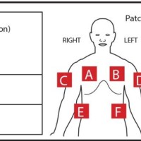 Transdermal Patch Placement Chart - Best Picture Of Chart Anyimage.Org